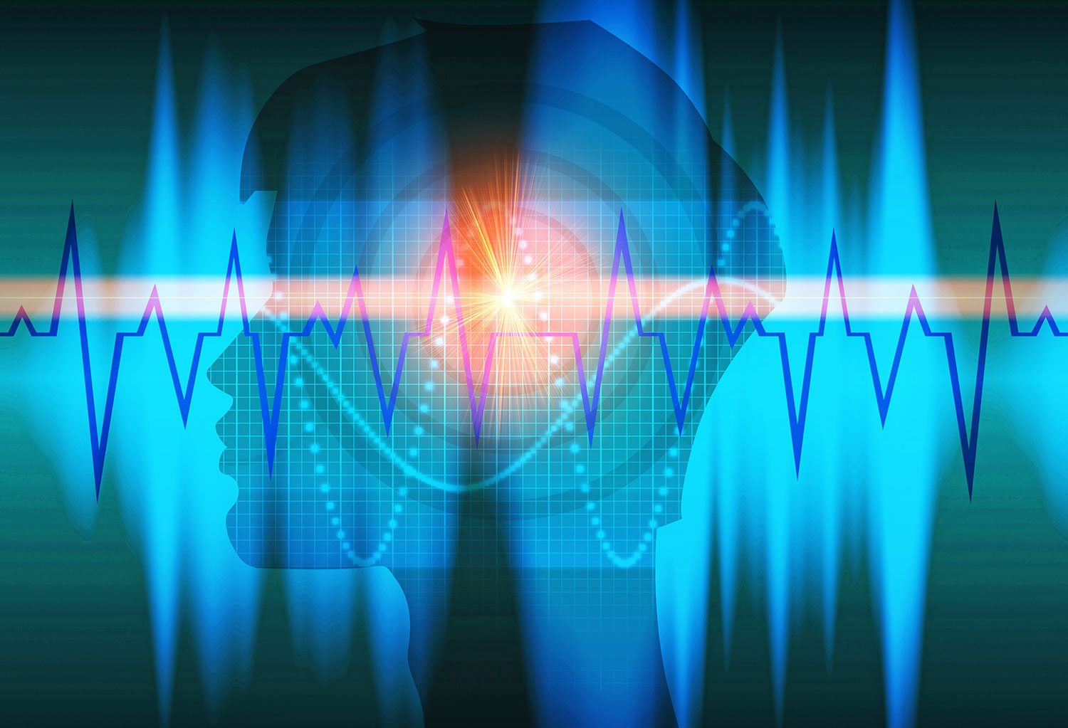 Neurofeedback | NeuroHealth Associates