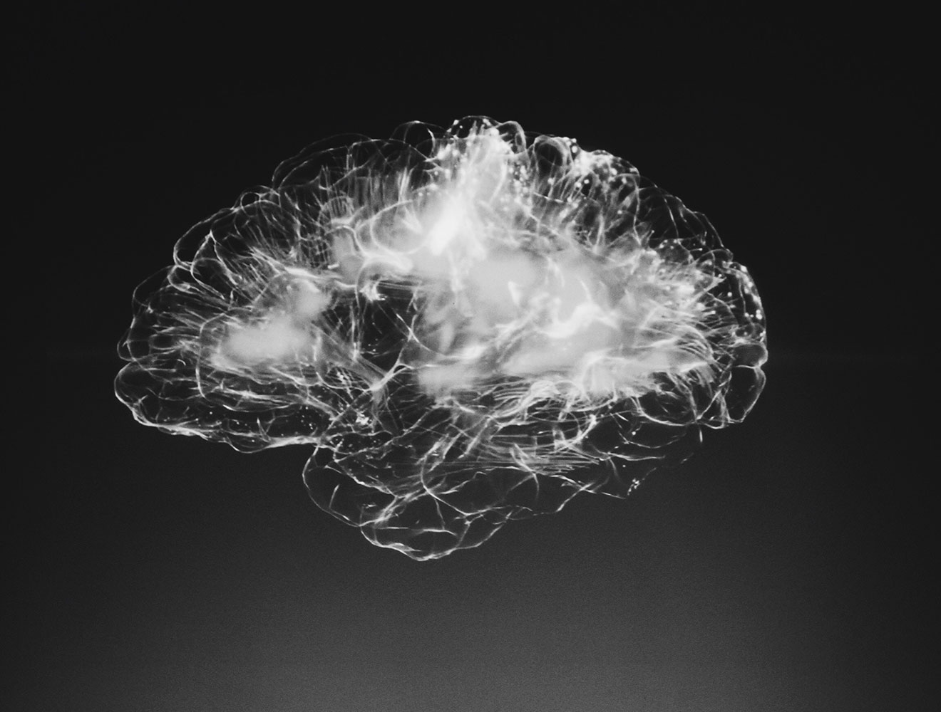 Exercise and brain connections, eases ASD in mouse model