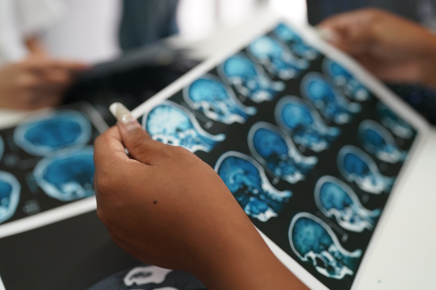 The Importance of Individualized Brain Mapping | NHA